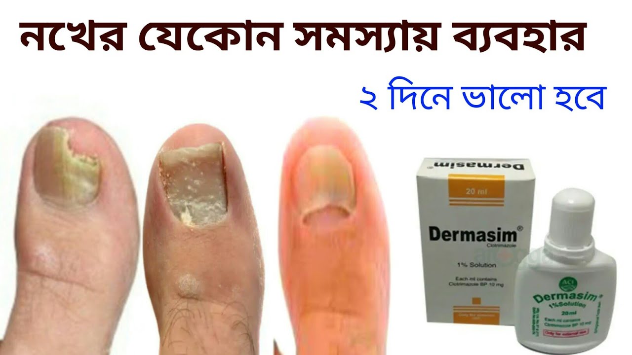 নখের যে কোন সমস্যা ভালো হবে।Dermasim solution ব্যবহার করলে ১০০% @Md ...