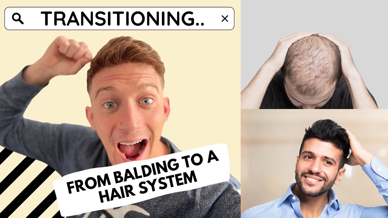 How to Transition from Bald to a CUTE FLOWING HAIR SYSTEM - YouTube