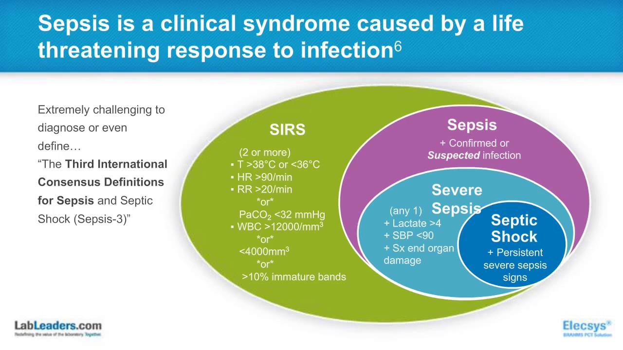 Procalcitonin Levels And Sepsis