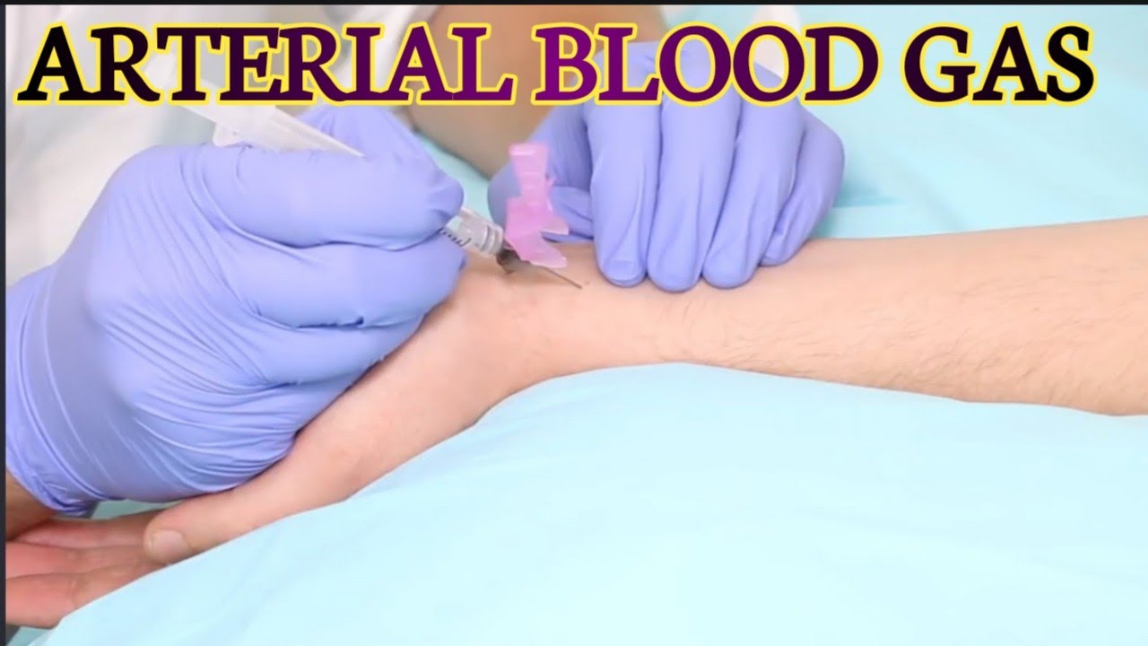 How To Take An Arterial Blood Gas Sample ll ABG Sample ll ABG ...