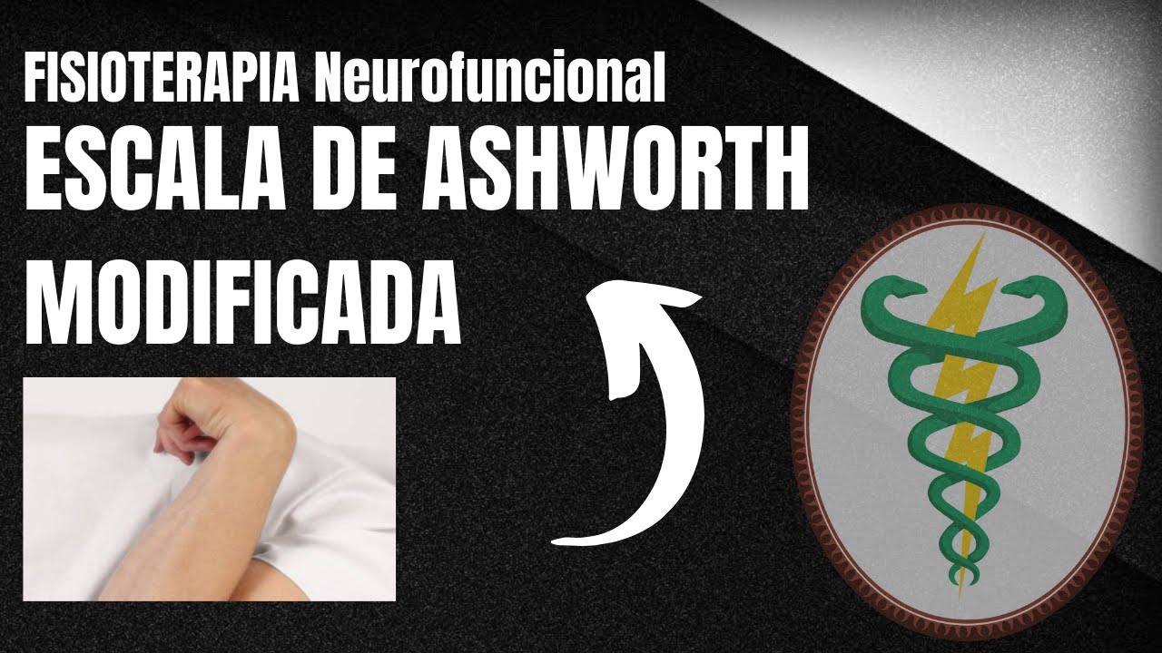 ESCALA DE ASHWORTH MODIFICADA | FISIOTERAPIA NEUROFUNCIONAL - YouTube