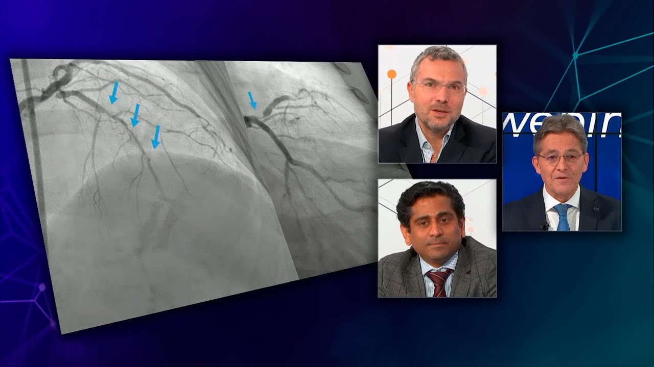 DCB digital crosstalk: practice patterns for patients with diabetes and ...