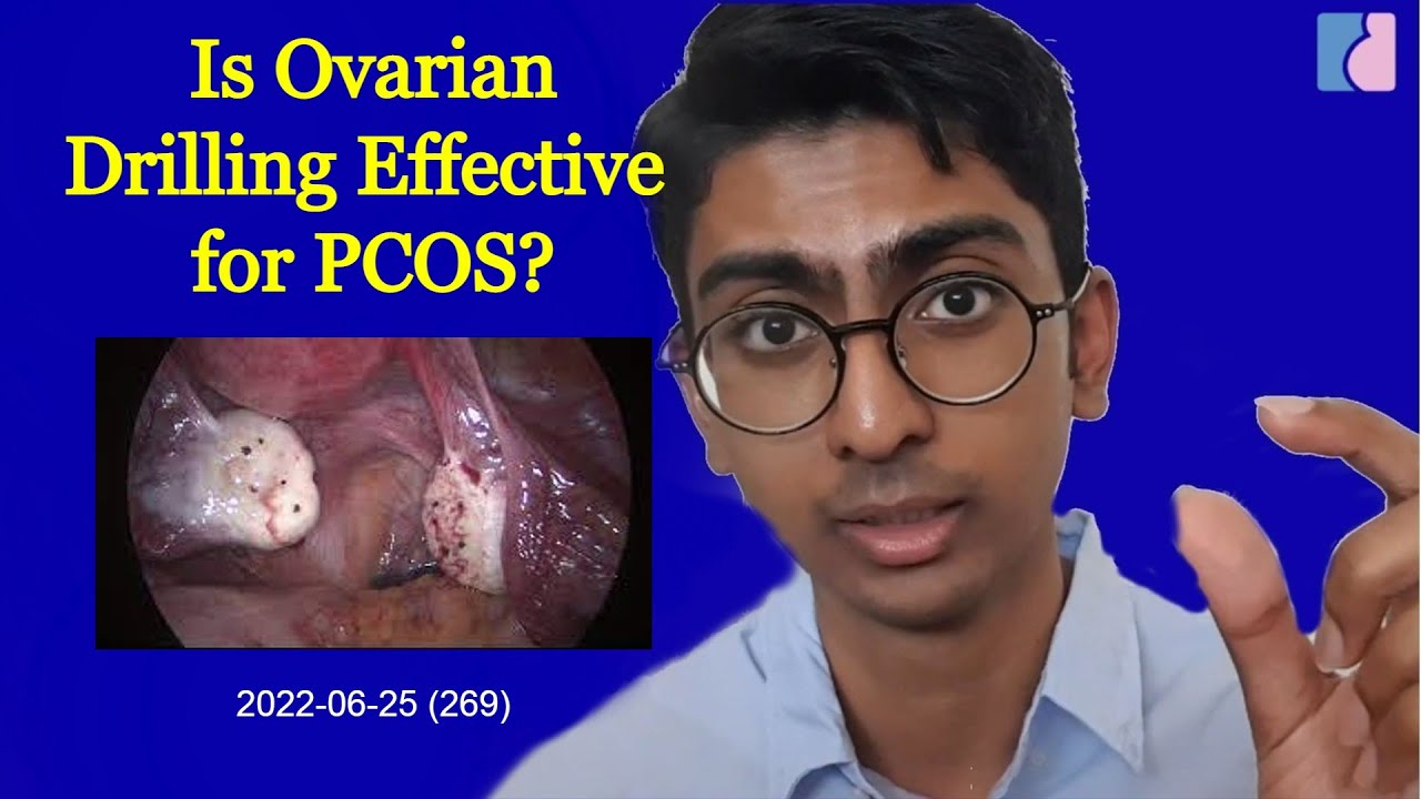Is Ovarian Drilling Effective For PCOS? - Antai Hospitals - YouTube
