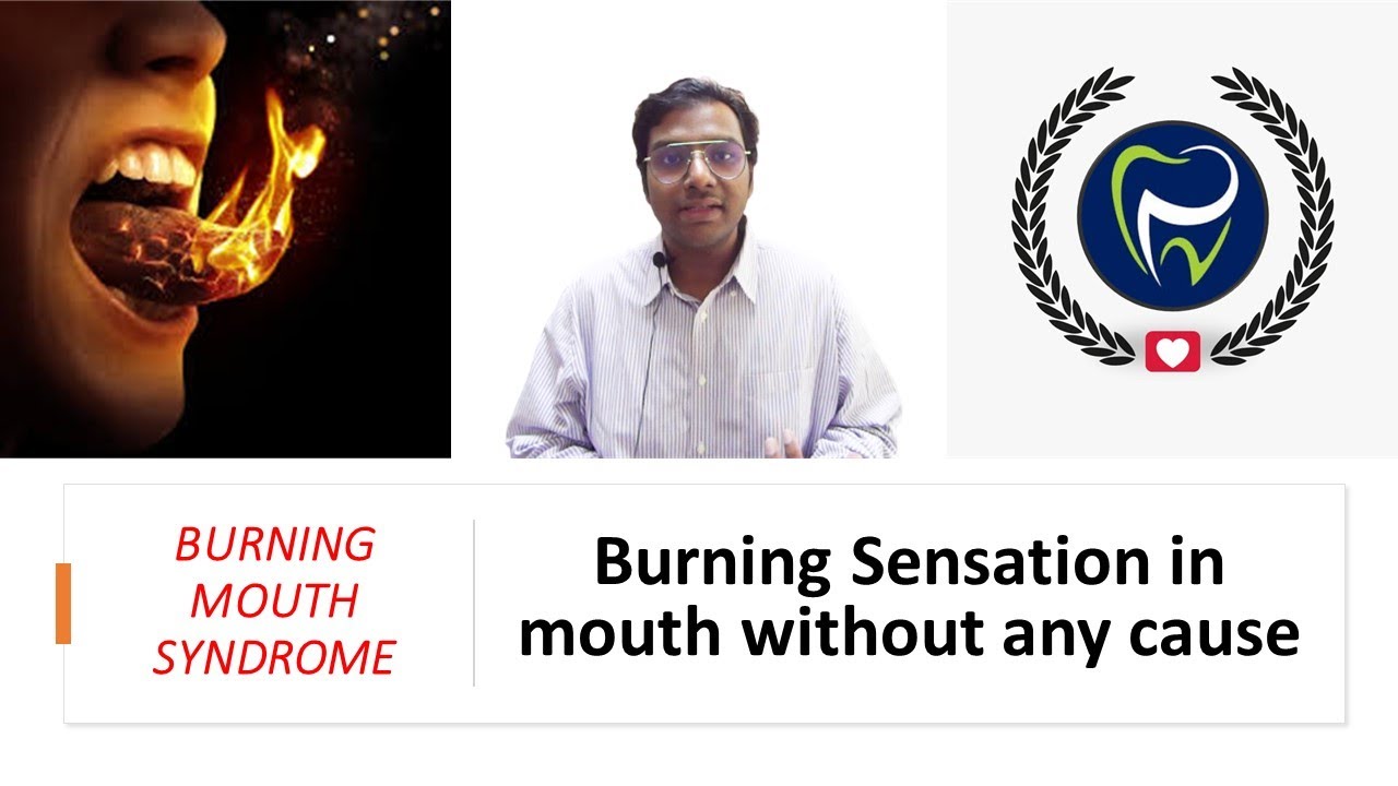 Dr Rudra Mohan | BURNING MOUTH SYNDROME (BMS) | ORAL BURNING WITHOUT ...