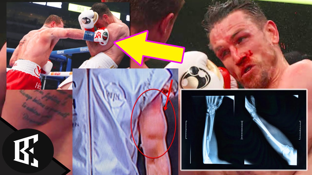ARMGATE! Canelo PUNCHED Callum Smith Arms 'MEAT OFF THE BONE', Arms ...