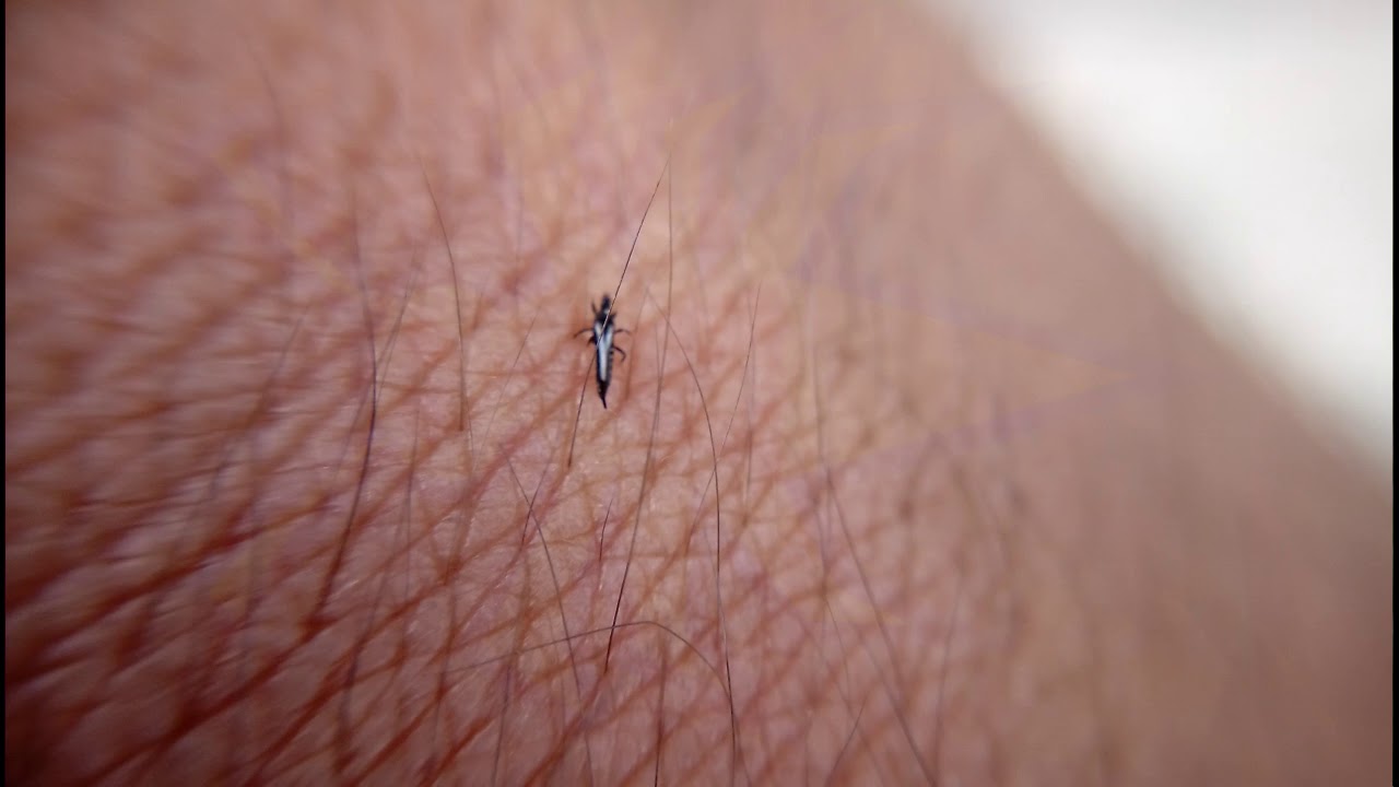 ¿Alguien Sabe Cómo se Llama Éste Pequeño Insecto Negro? - YouTube