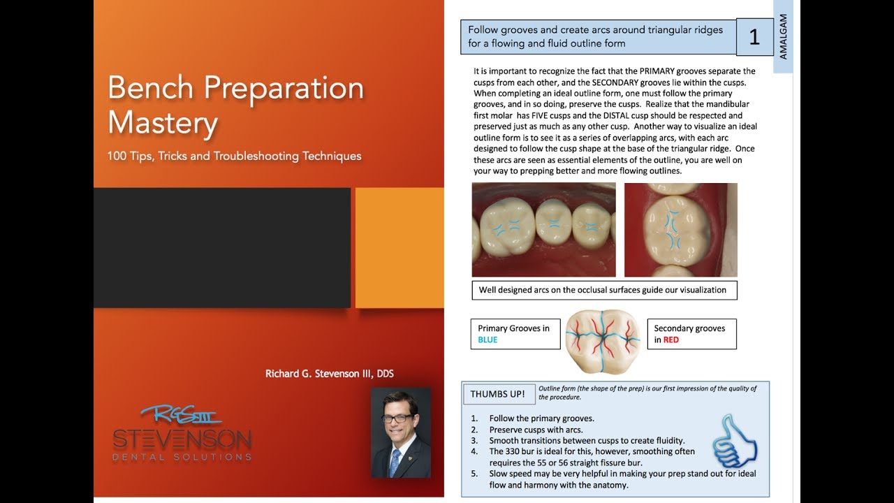 99 Seconds Tips - Outline Planning | Class II Amalgam Preparation - YouTube