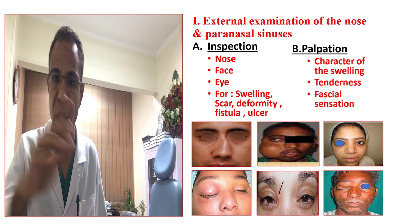 Nose & sinus examination | ENT | 4th grade | by Dr. Mohamed Omar Gad ...