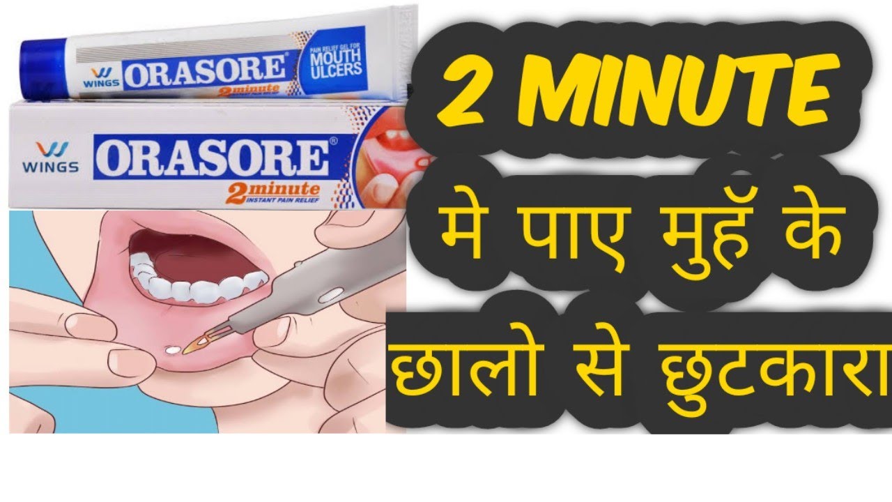 Orasore Mouth Ulcer Gel Review | Orasore Mouth Ulcer Gel How to Use ...