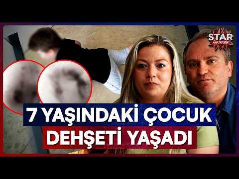 7 Yaşındaki Çocuğu Köpek Isırdı, Sahibinin Pişkin Savunması 'Pes Artık' Dedirtti! | Star Ana Haber