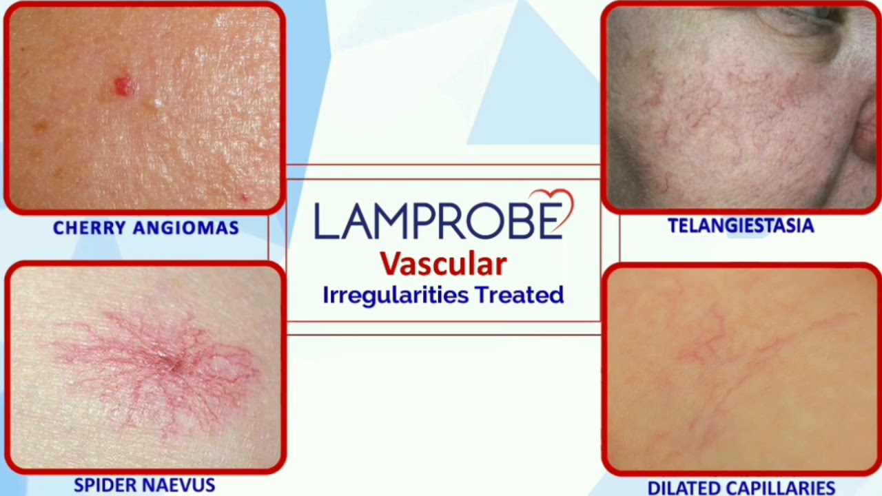 LAMPROBE - Short Overview_cl - YouTube