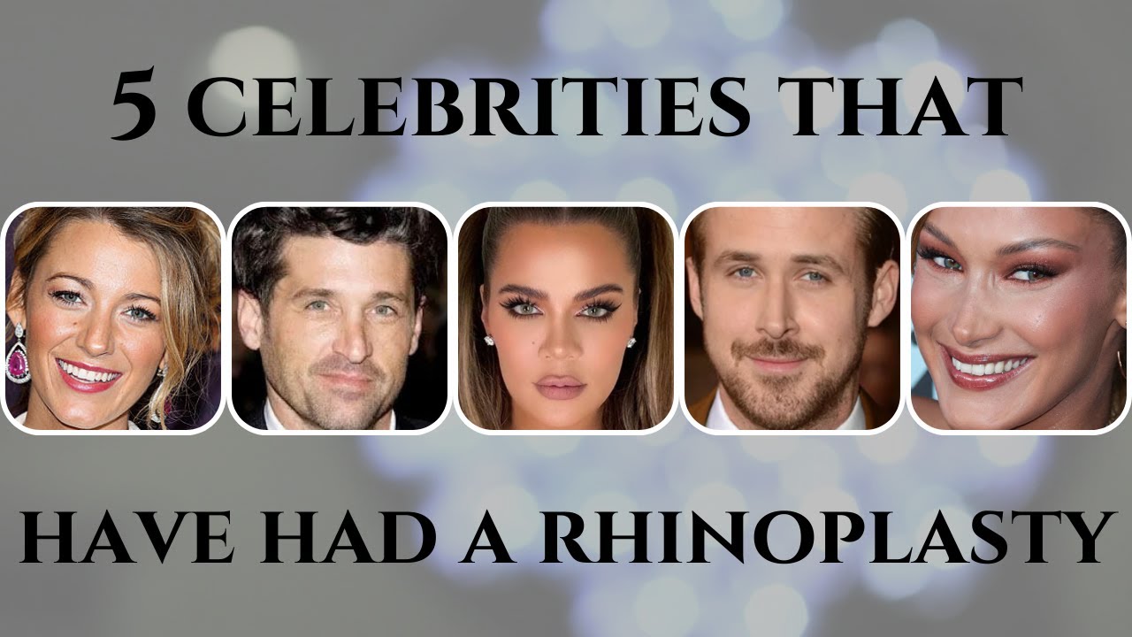 5 Celebs Who Have Had a Rhinoplasty, Plastic Surgeon Explains: Khloe ...