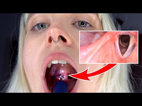 Tiny dentist examines Freya's guts - YouTube