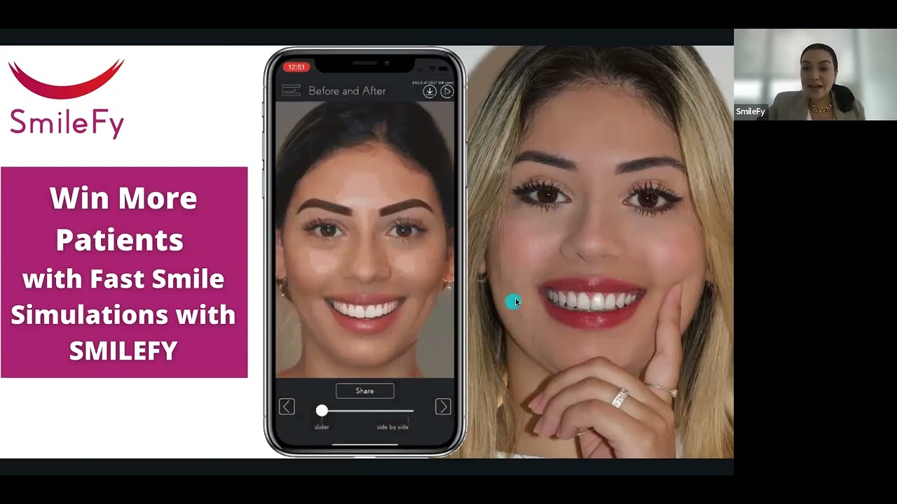 Create Smile Simulation with a few clicks with Smilefy - YouTube