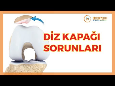 DİZ KAPAĞI SORUNLARI VE DİZ KAPAĞI TEDAVİLERİ