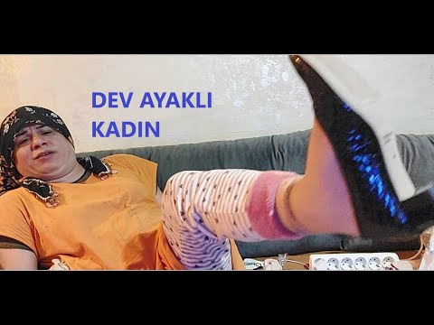 KOCA İKİ AYAKLI KADIN GİYECEK AYAKKABI BULAMIYOR