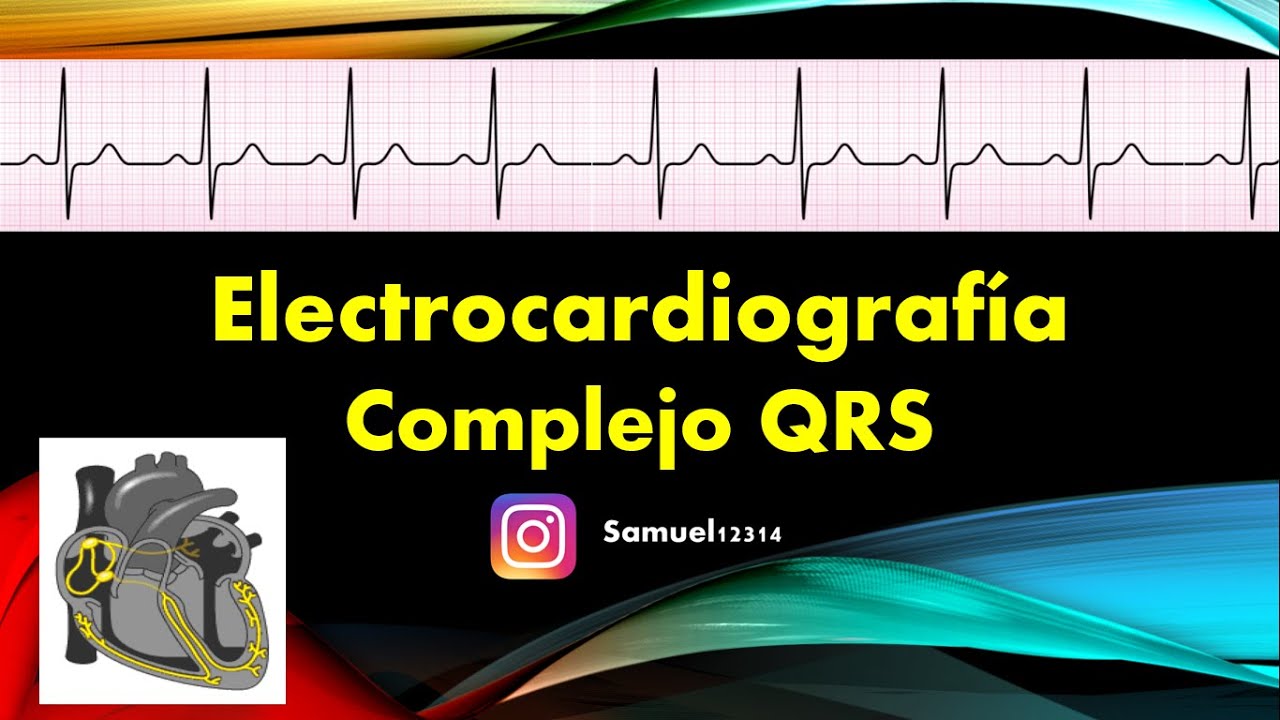 🏅 ELECTROCARDIOGRAMA (7) complejo QRS🫀 - Hipertrofia Ventricular ...