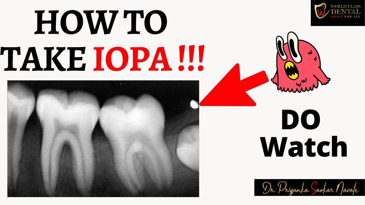 How to Take IOPA | World Class Dental | Dr Priyanka Saokar Navale - YouTube