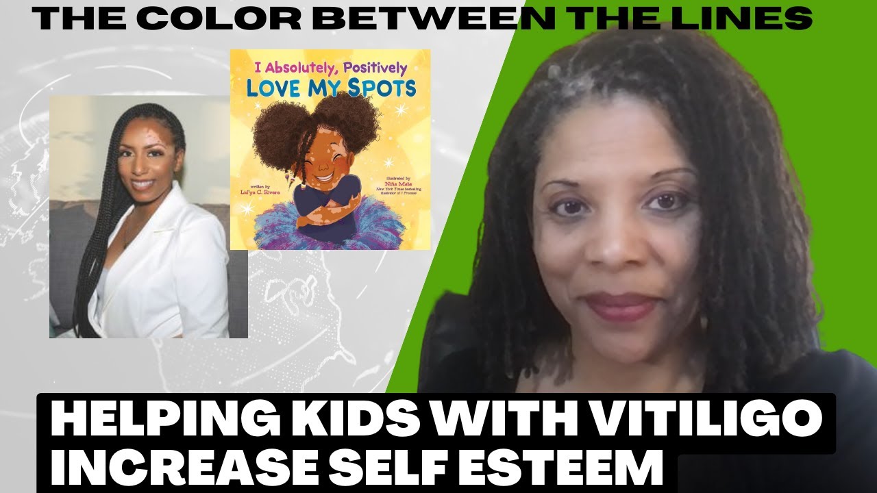 🌈 Lydia Rivera on 'I Absolutely Positively Love My Spots' | Empowering ...