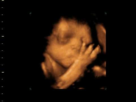 30 Weeks, 4D Ultrasound, Tara and Jackie's Baby - YouTube