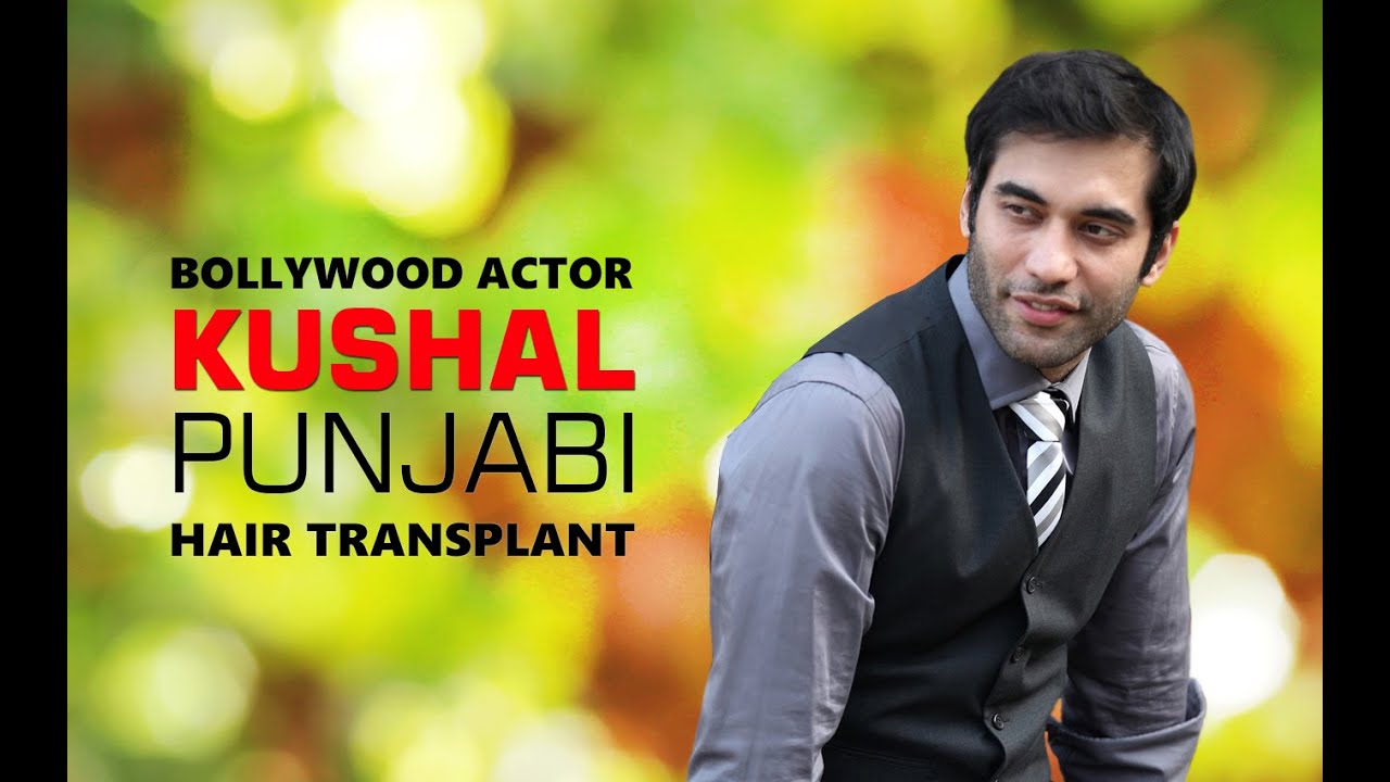Bollywood Actor Khushal Punjabi Gets Hair Transplant | Dr. A's Clinic ...
