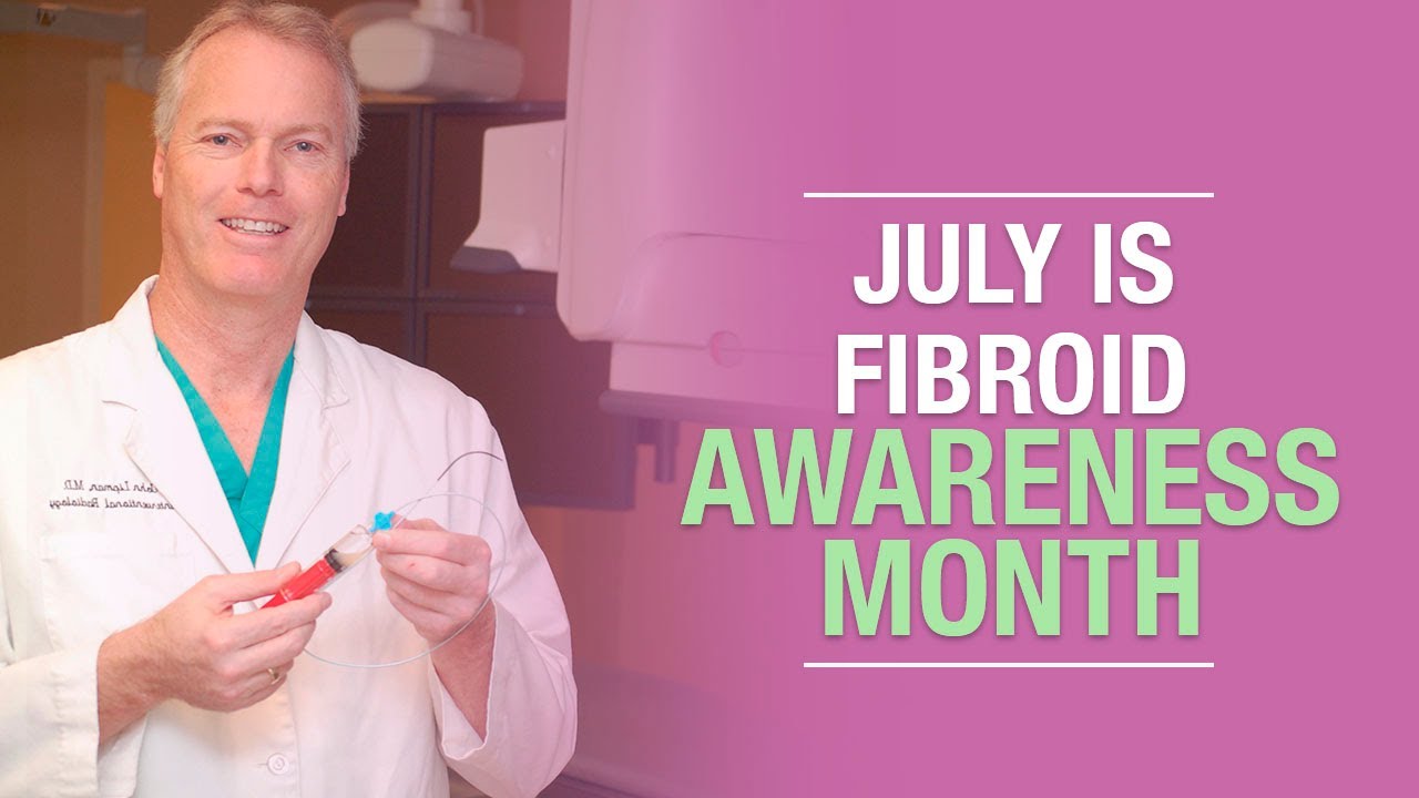 July Is Fibroid Awareness Month: #DontLoseUrU Campaign - YouTube