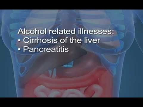 Alcoholism 1- Definition, health consequences, symptoms - YouTube