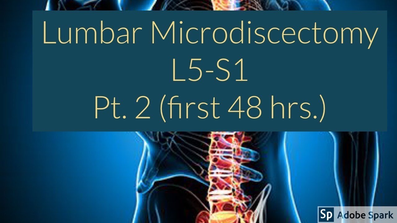 Lumbar Microdiscectomy - L5/S1, Pt. 2 (first 48 hrs. post op) - YouTube