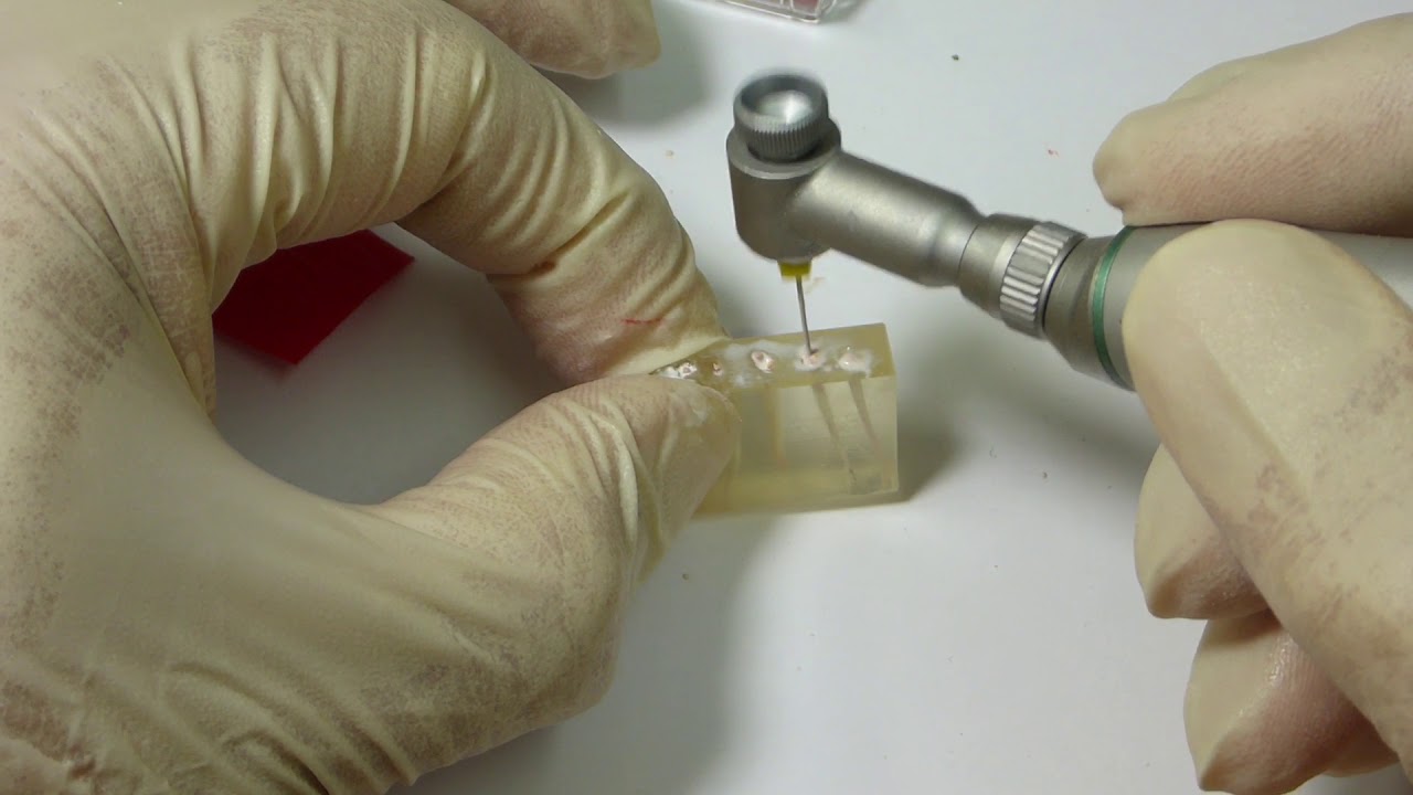 GP除去こんなに簡単です。安全なのにこんなにハイパワーです。 - YouTube