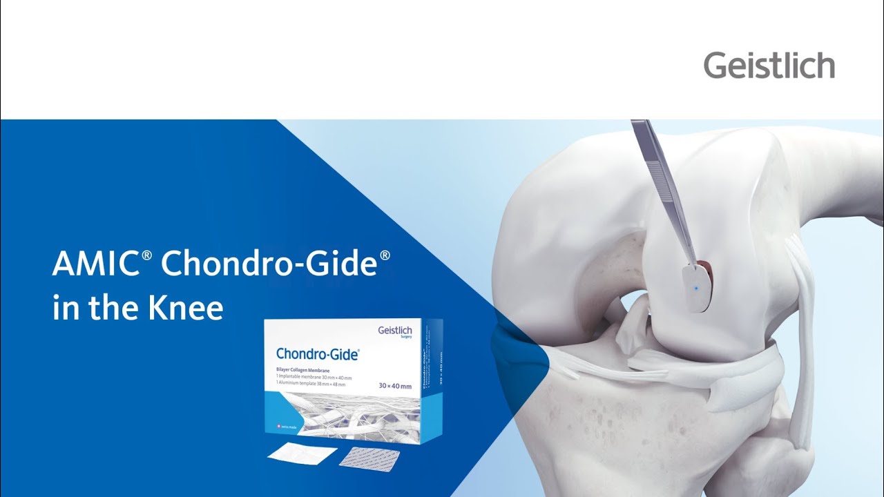 AMIC® Chondro-Gide® in the Knee - YouTube