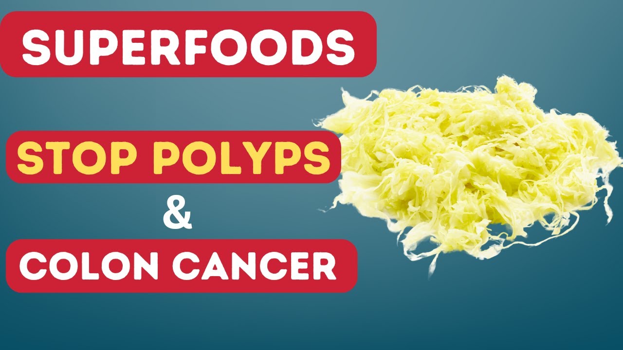 10 Superfoods And 4 Worst Foods To Prevent Polyps And Colon Cancer