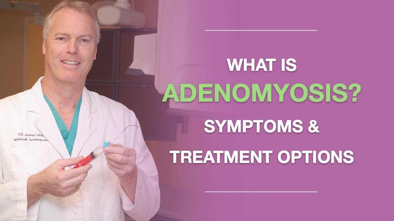 What Is Adenomyosis Common Symptoms And Treatment Options Youtube