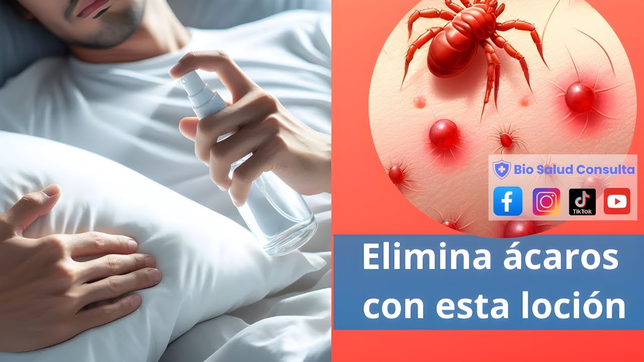 Loción Para Eliminar Ácaros (Bio Salud Consulta) - YouTube