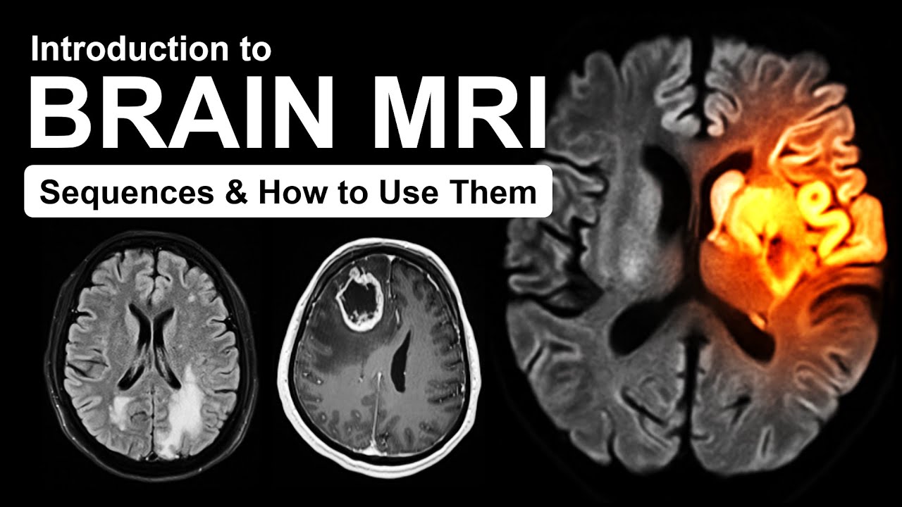 Introduction to Brain MRI: Routine Sequences and How to Use Them - YouTube