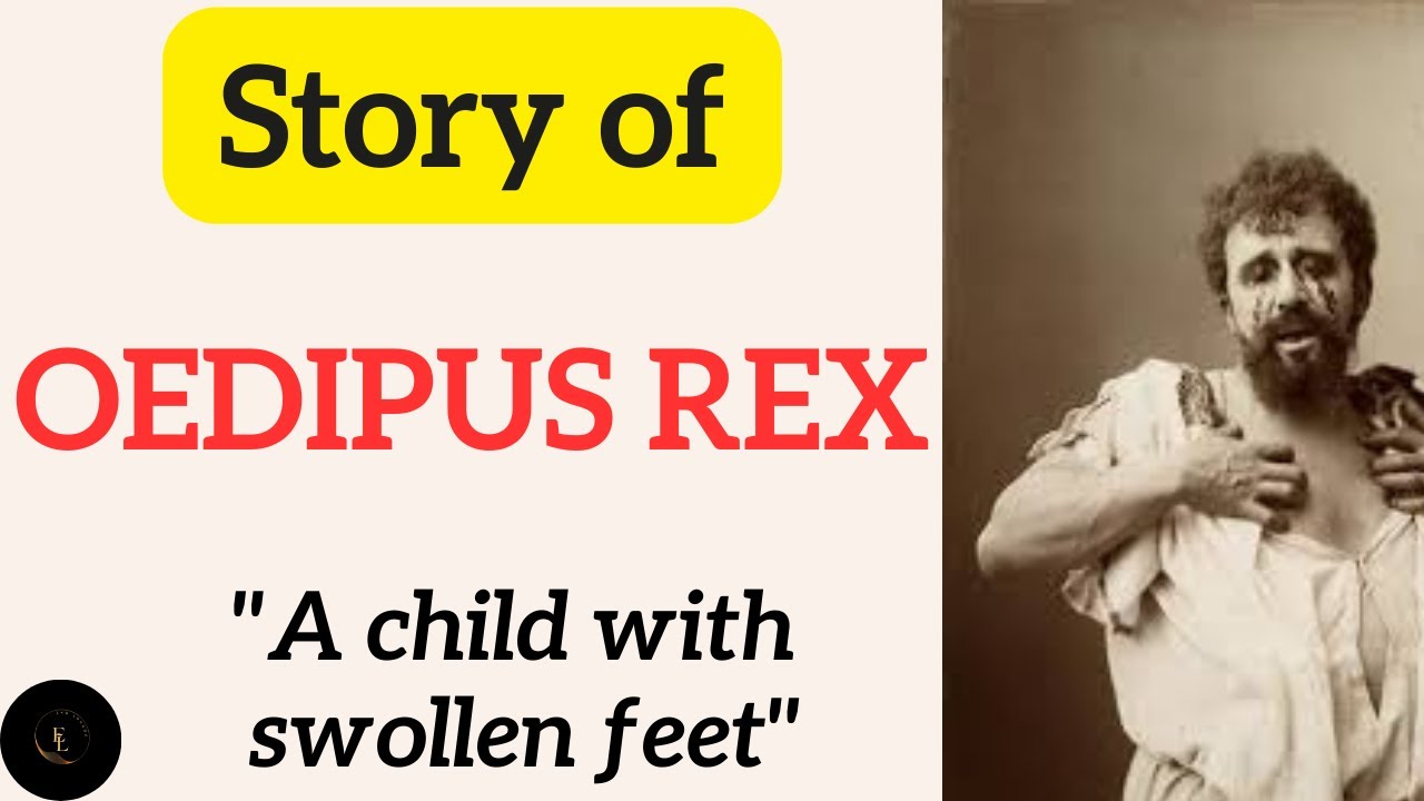 Story of Oedipus Rex || Greek Mythology || Swollen feet kid || King of ...