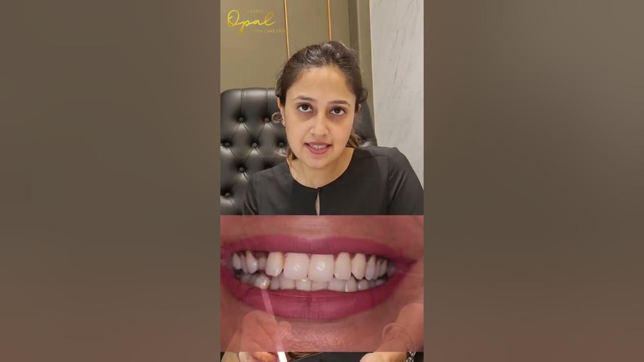 Dr. Aastha Chandra | Painless, Non Invasive, Affordable And Quick Smile Transformation - YouTube