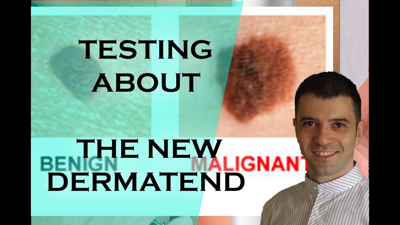 THE TESTING ABOUT THE NEW DERMATEND - YouTube
