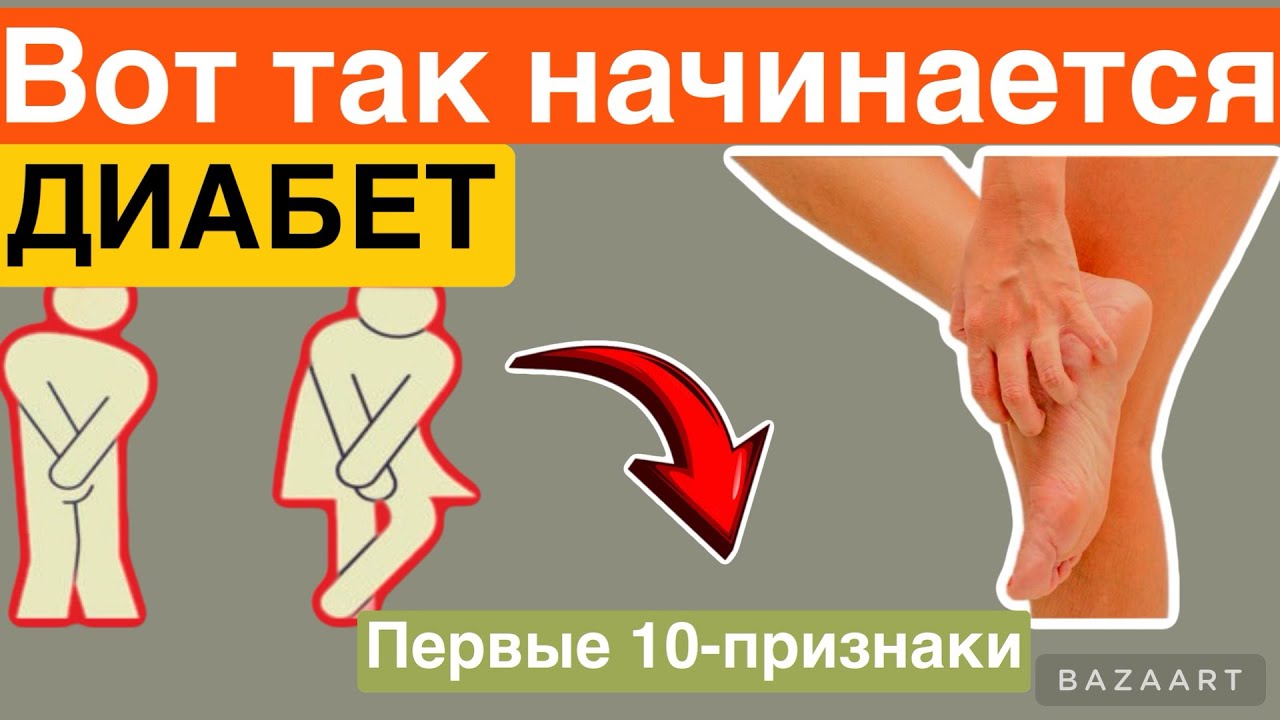 У вас нет диабет но есть 10 признаки сахарного диабета Что делать