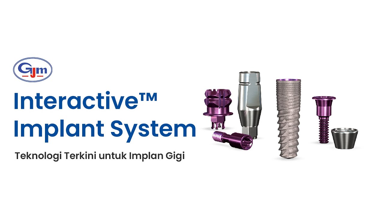 Interactive™ Implant System, Teknologi Terkini untuk Implan Gigi - YouTube