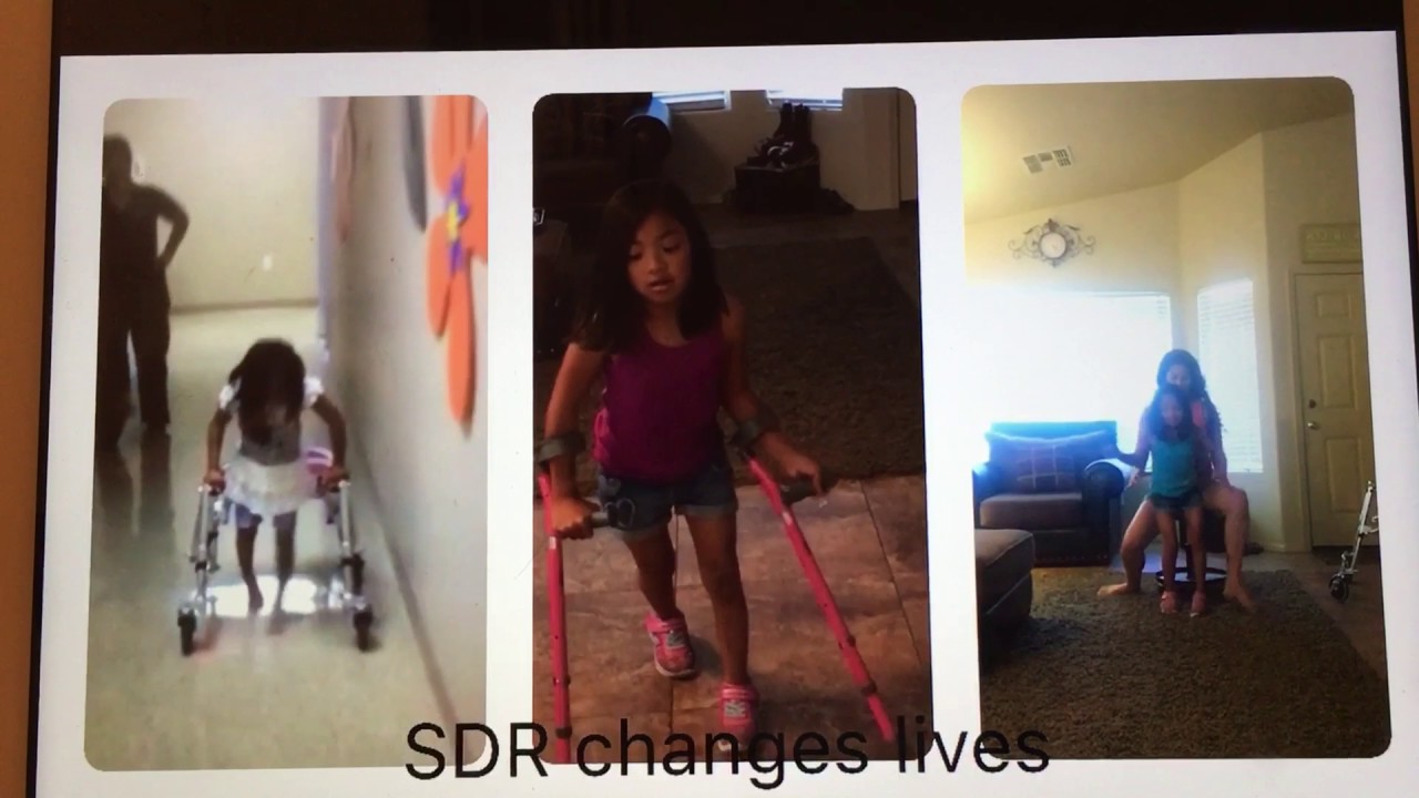 SDR Changes lives - YouTube