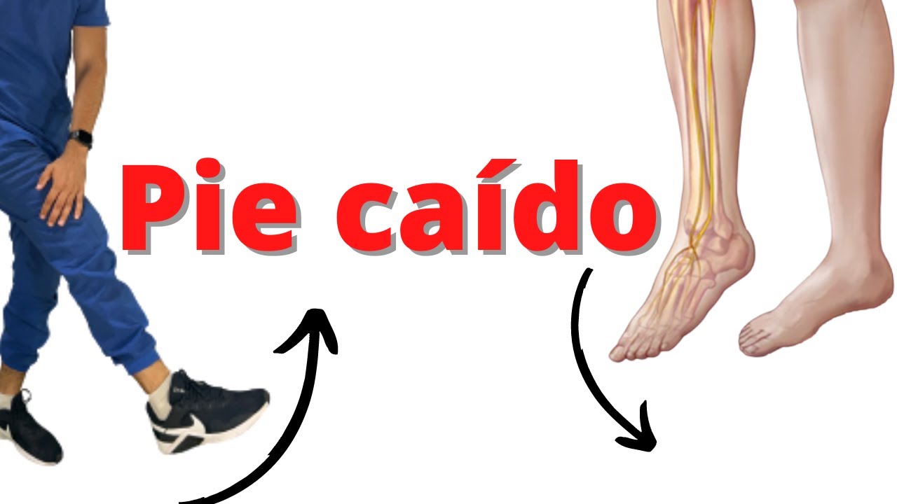 Pie caído ejercicios para estimularlo - YouTube