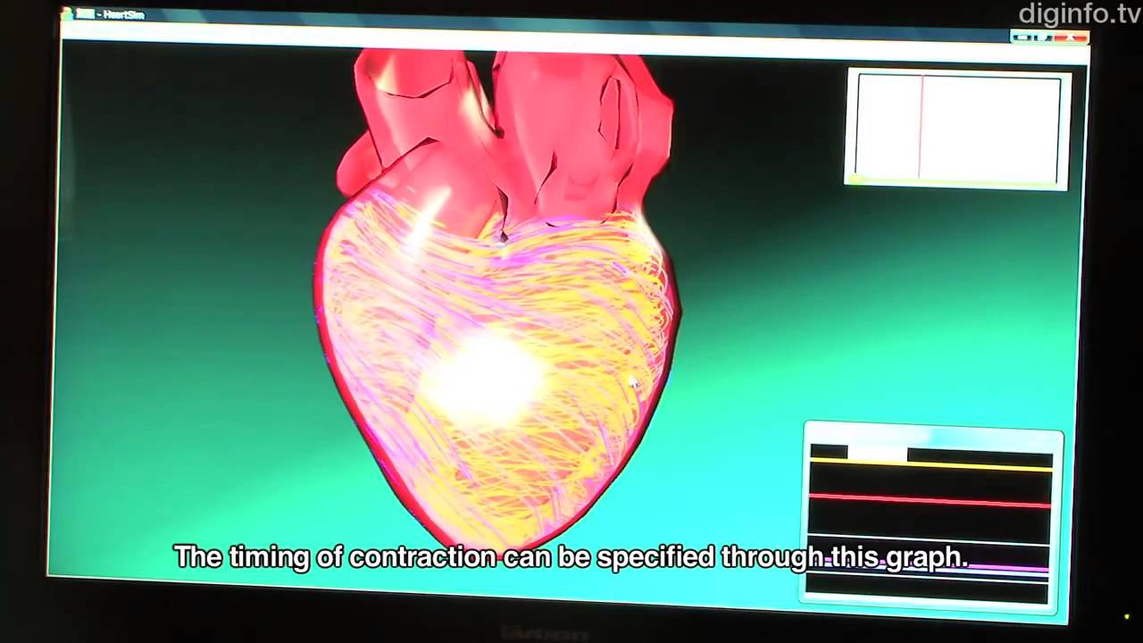 Real time heart beat simulator visualizes pulsation and disease on a ...