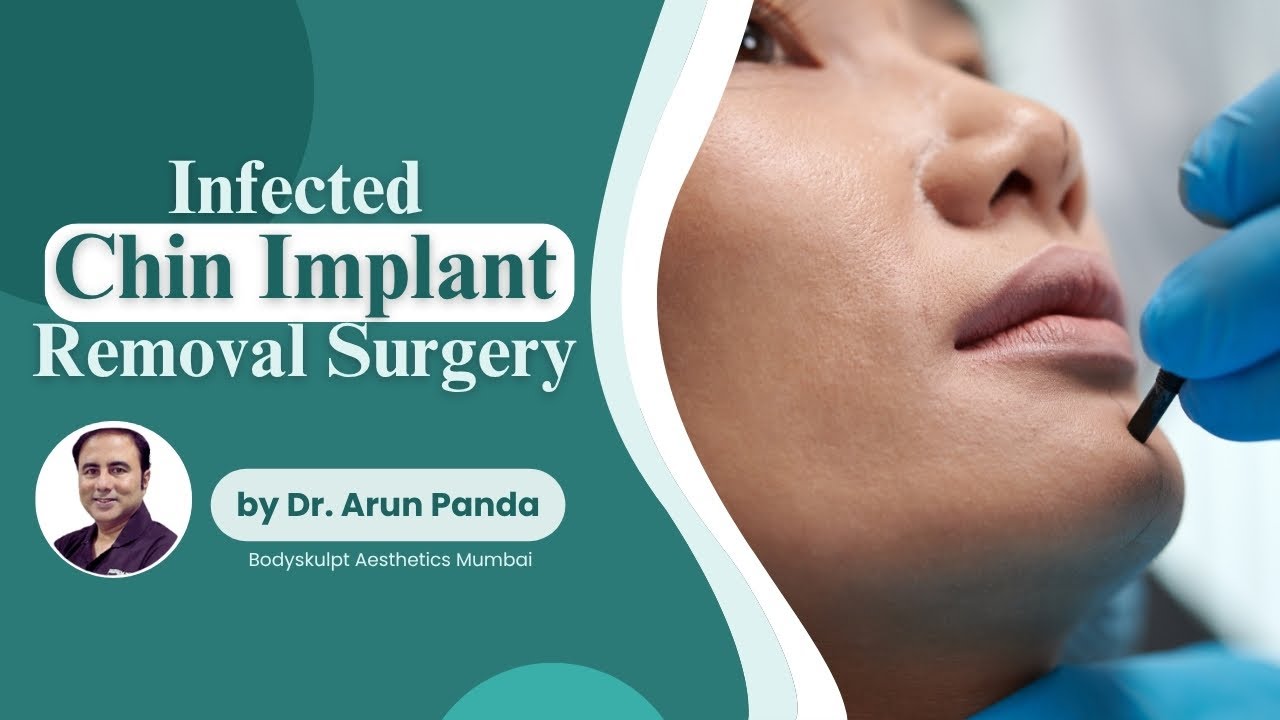 Infected Chin Implant Removal Surgery | Dr Arun Panda | Bodyskulpt ...