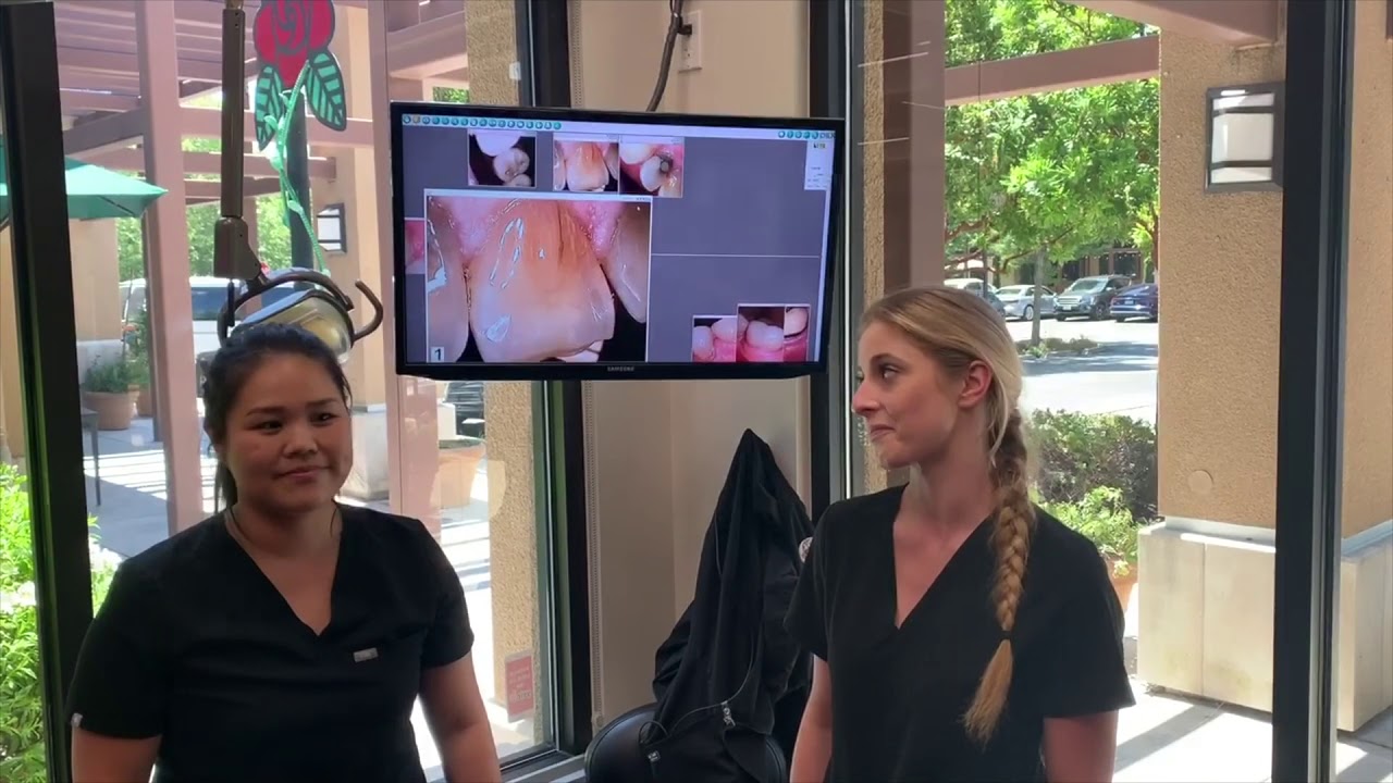 Registered Dental Hygienists Upgrades IRIS 2.0 Intraoral Camera to the ...