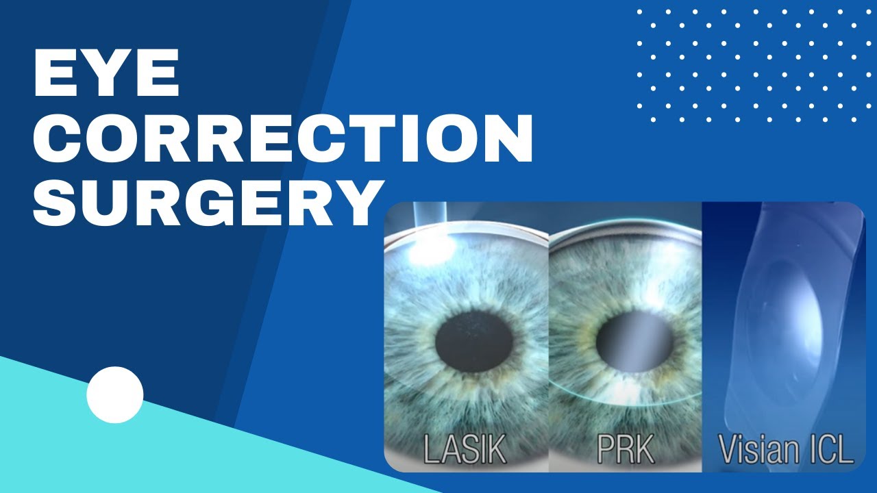 Eye Correction Surgery: LASIK - PRK - VISIAN ICL - YouTube