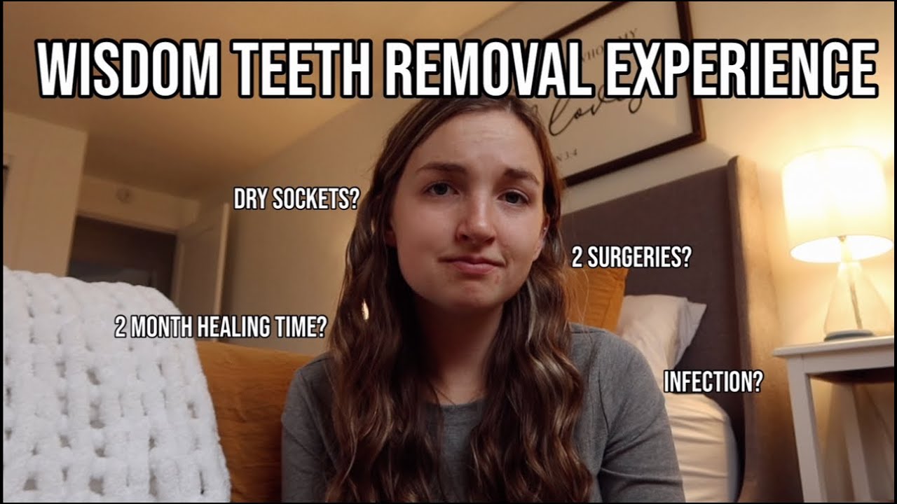 My Wisdom Teeth Removal Experience (Dry Sockets + Infection) - YouTube