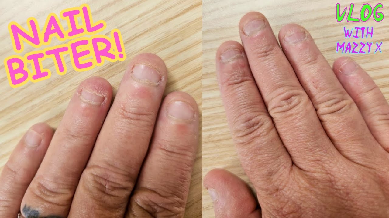 EXTREME Transformation: Years Of Nail BITING!! - YouTube