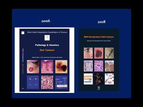Bases des classifications et moyens diagnostiques des tumeurs 🤩 ...
