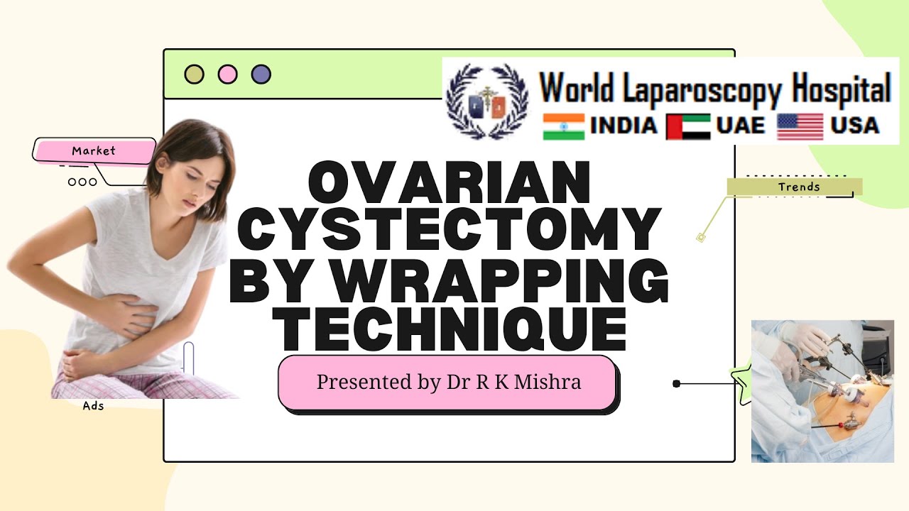 Ovarian Cystectomy by Wrapping Technique - YouTube