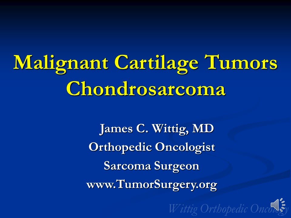 Orthopedic Oncology Course - Malignant Cartilage Tumors (Chondrosarcoma ...